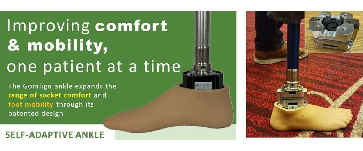 Self-Aligning Prosthetic Ankle – Impulse Technology